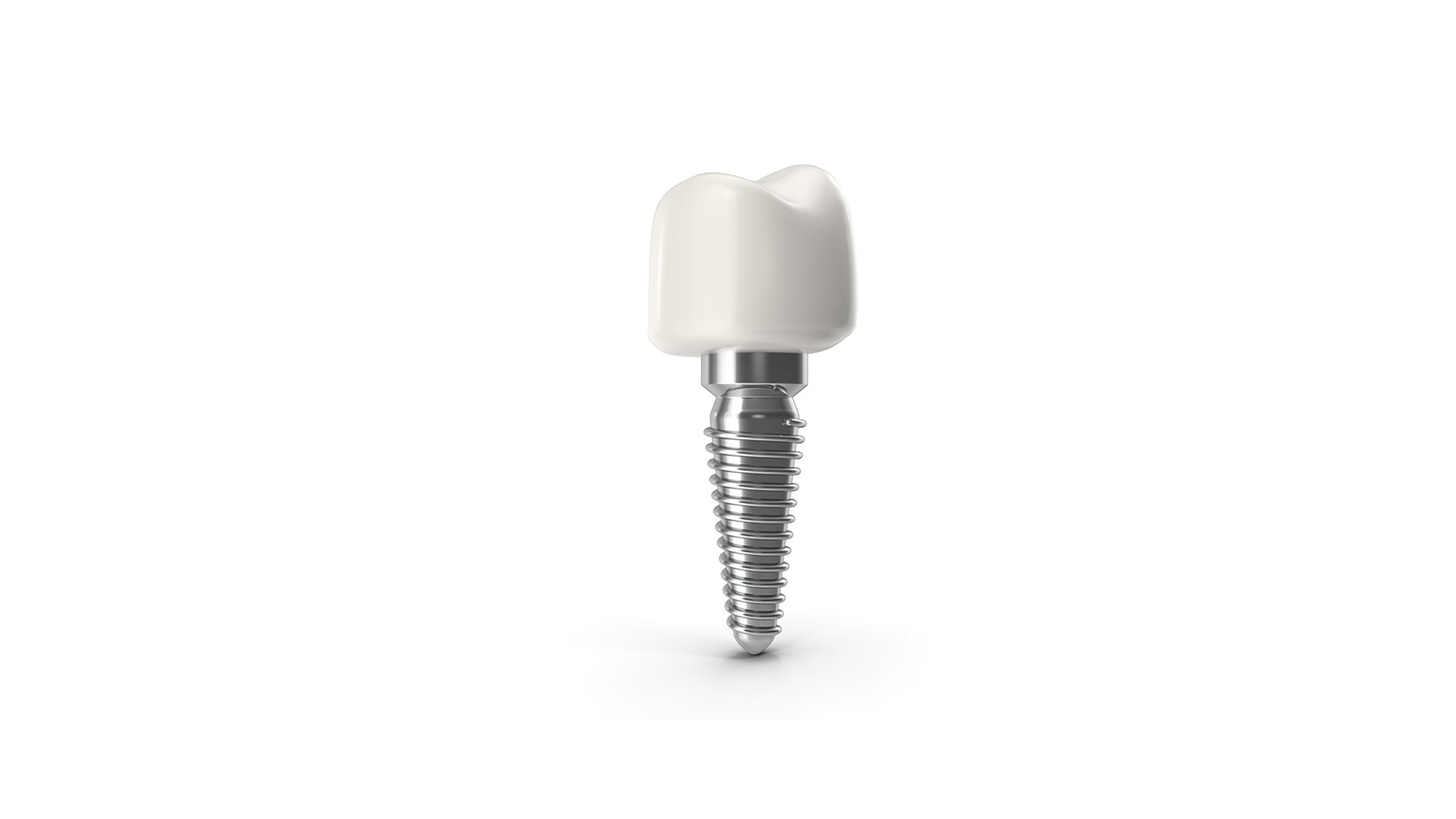Tooth Implant 3D Model - TurboSquid 2126551