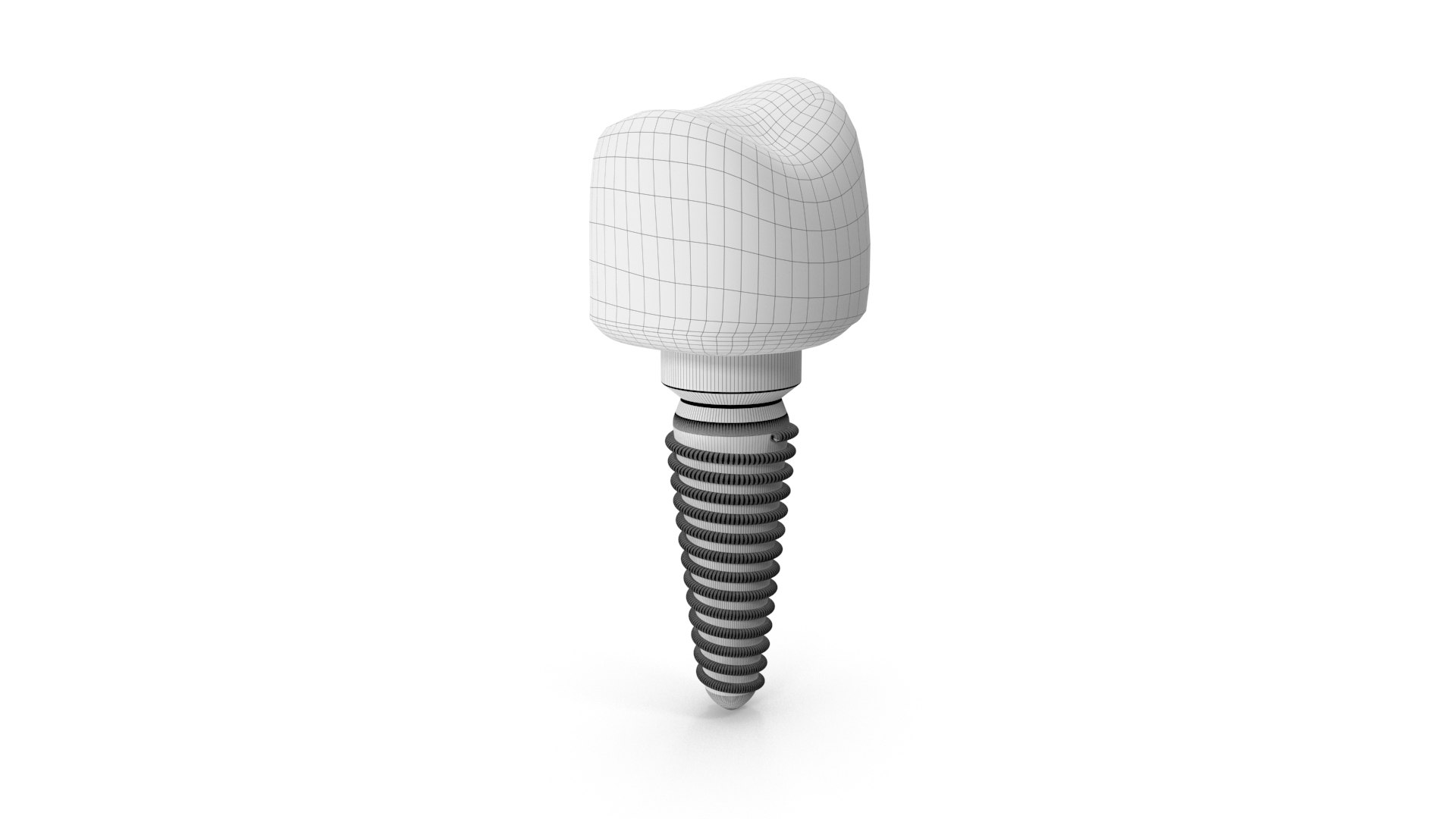Tooth Implant 3D Model - TurboSquid 2126551