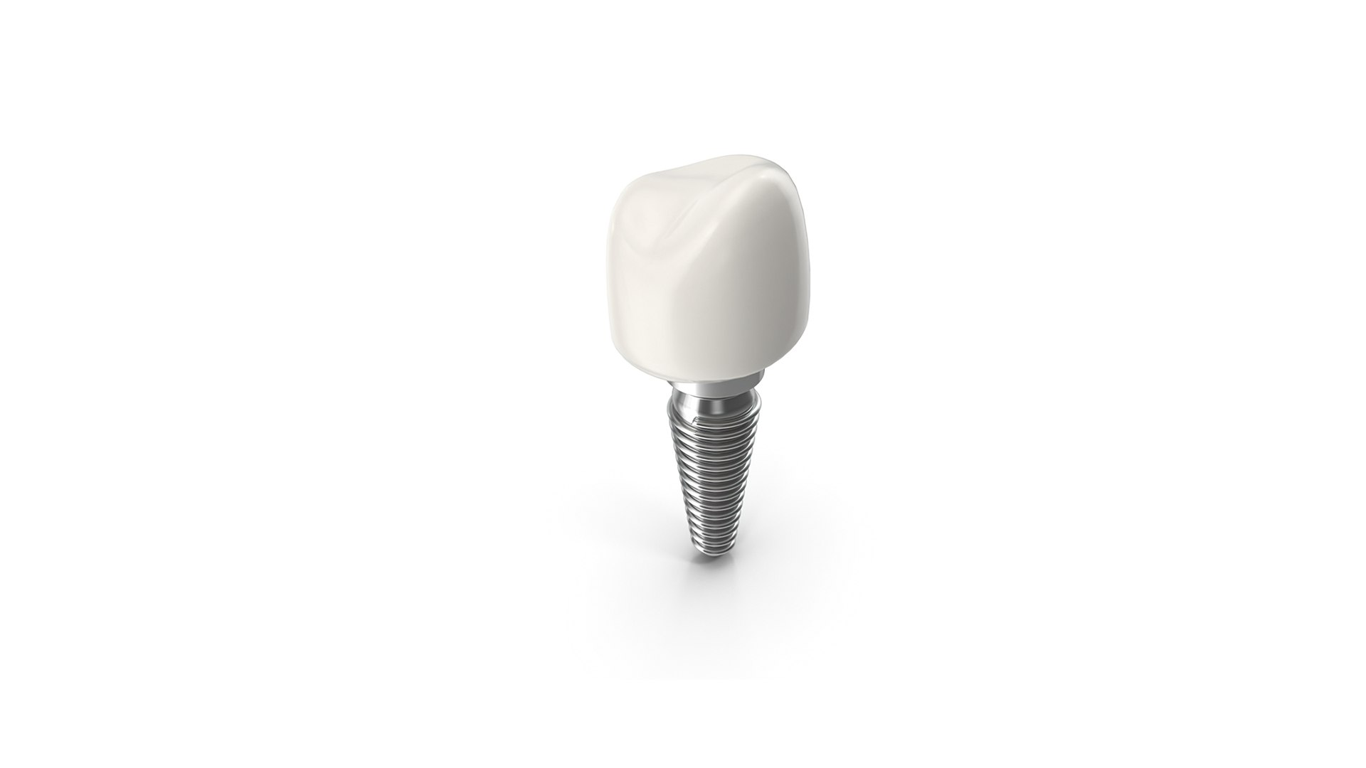 Tooth Implant 3D Model - TurboSquid 2126551