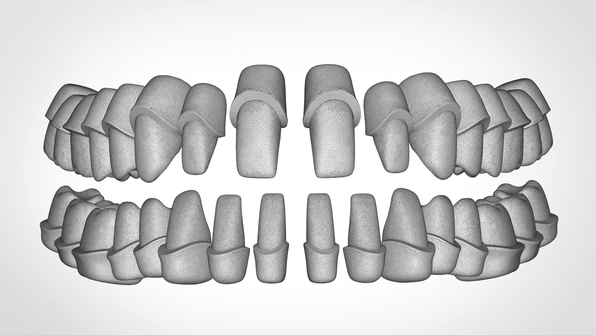 3D model dental anatomy library thimble - TurboSquid 1399859