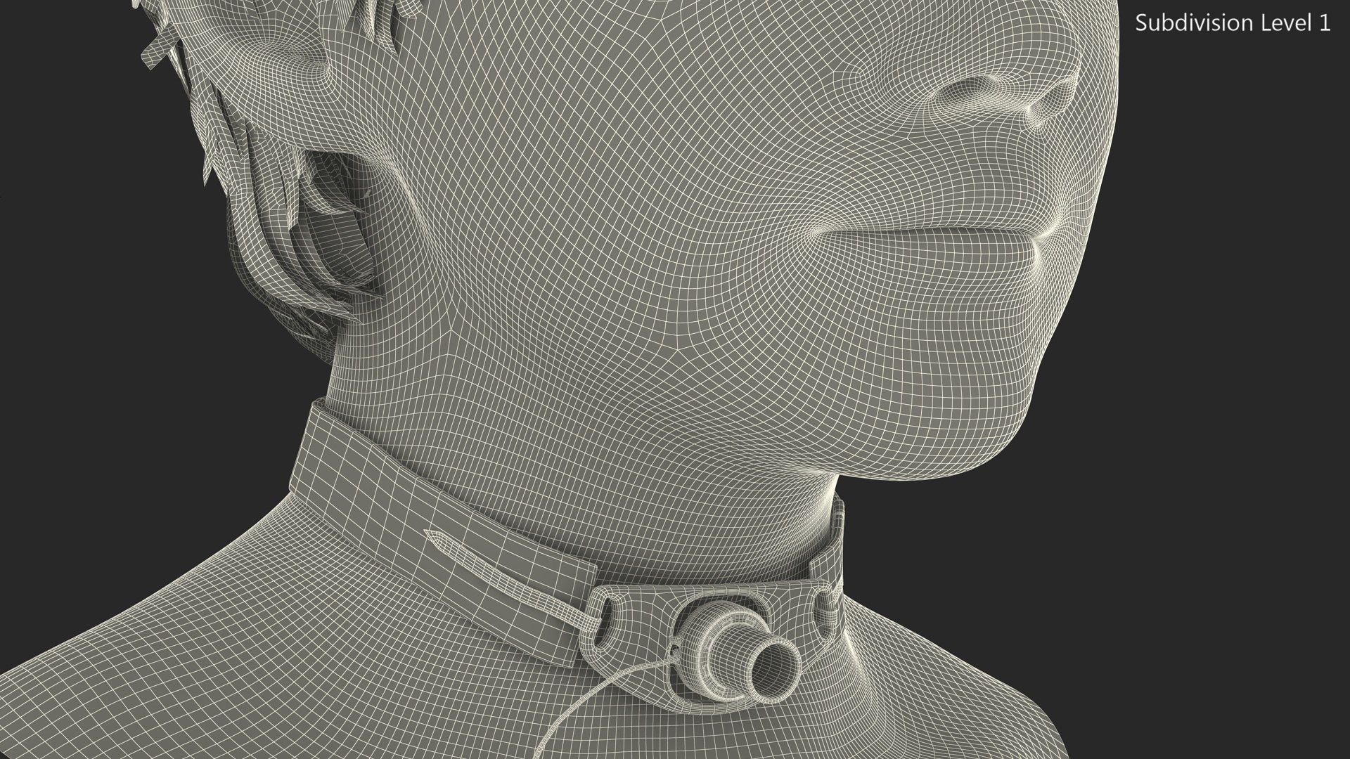 3D Tracheostomy Tube With Neckband Installed On Patient Model ...