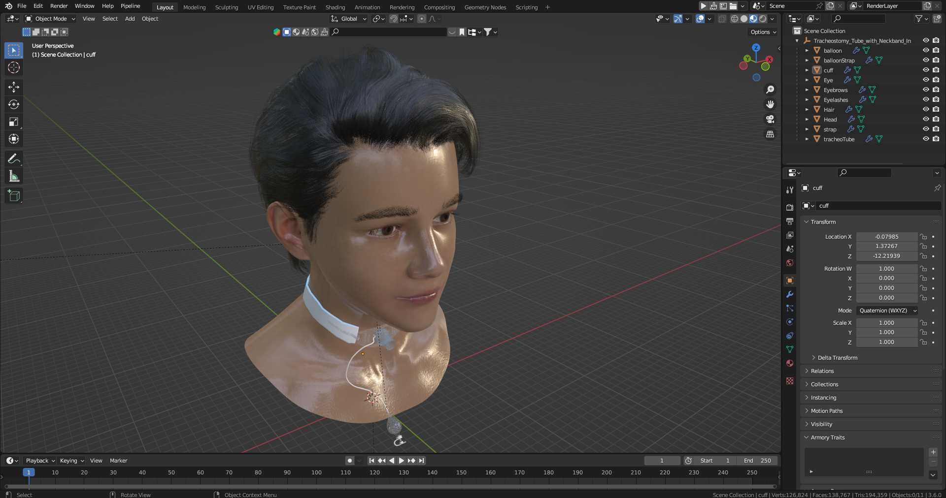 3D Tracheostomy Tube With Neckband Installed On Patient Model ...