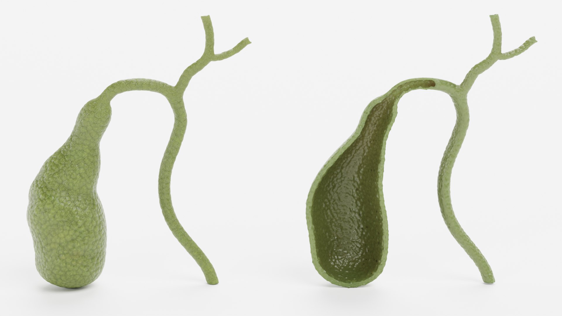 3D Gallbladder And Gallbladder Section Model - TurboSquid 1756726