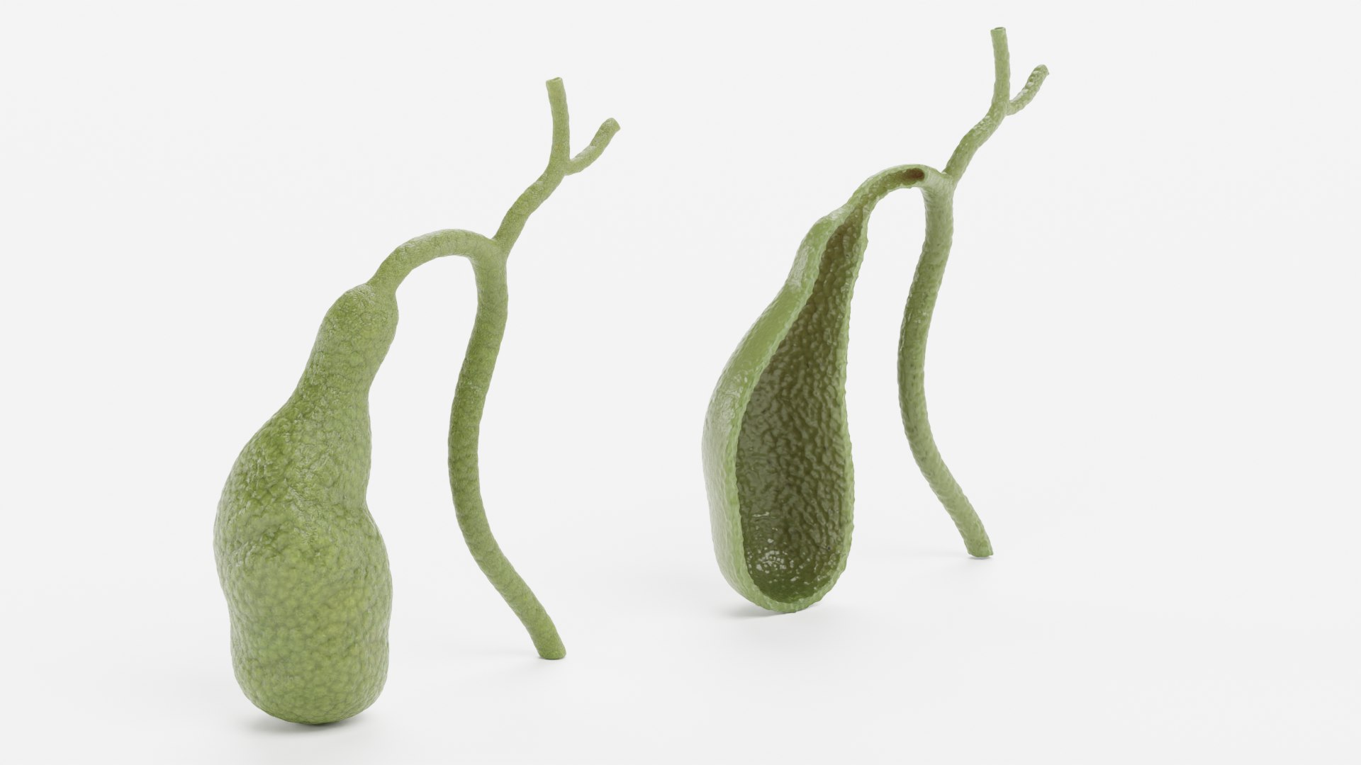 3D Gallbladder And Gallbladder Section Model - TurboSquid 1756726