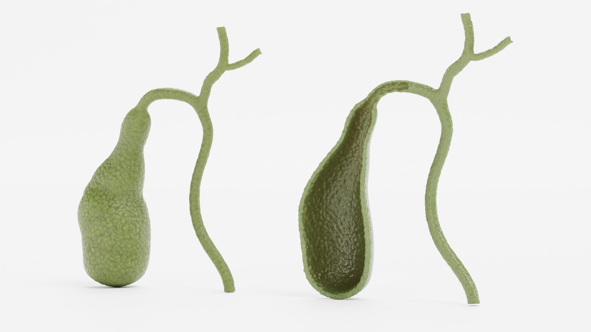 3D Gallbladder And Gallbladder Section Model - TurboSquid 1756726