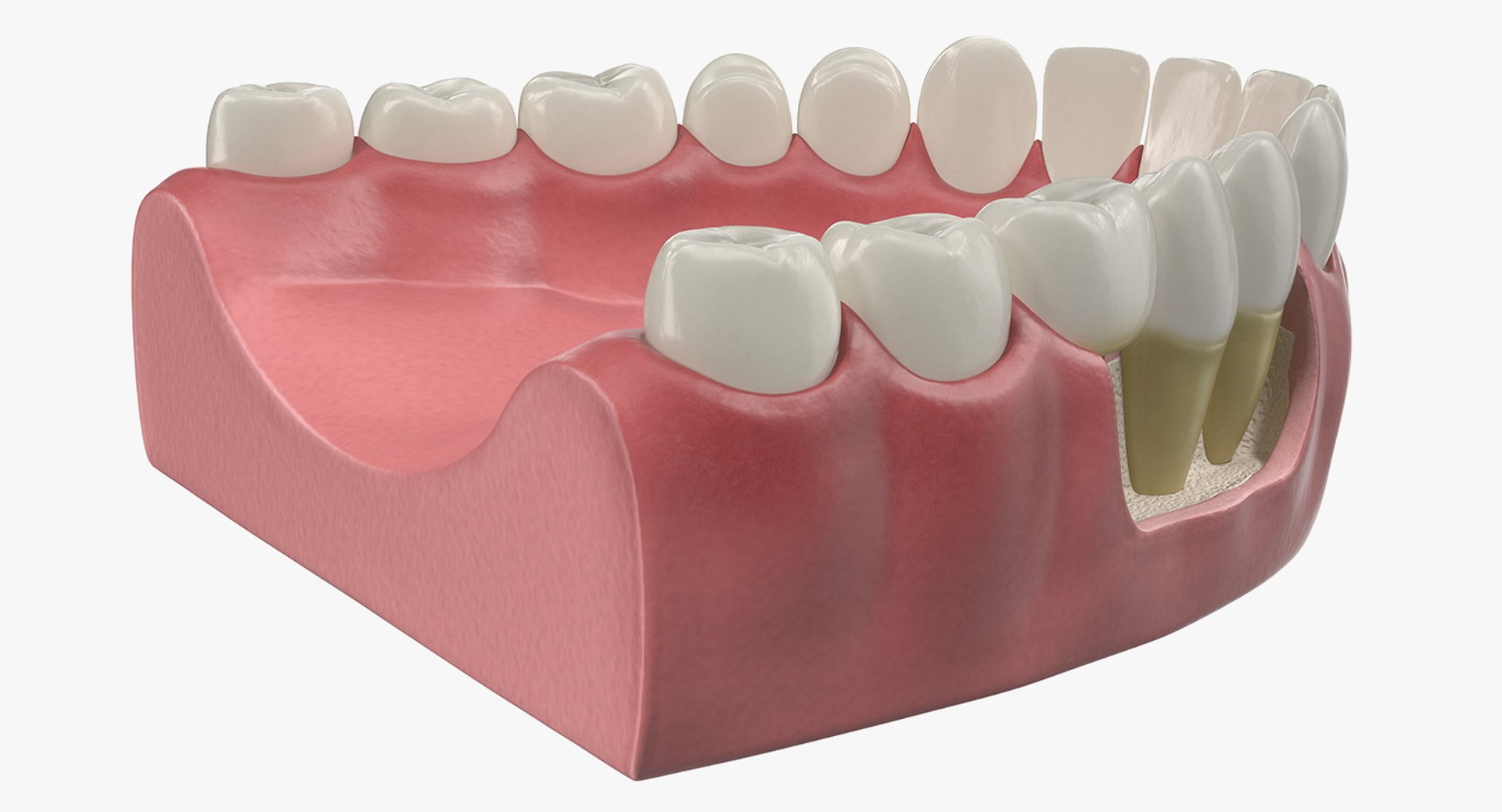 Lower teeth medical dental 3D model - TurboSquid 1428835