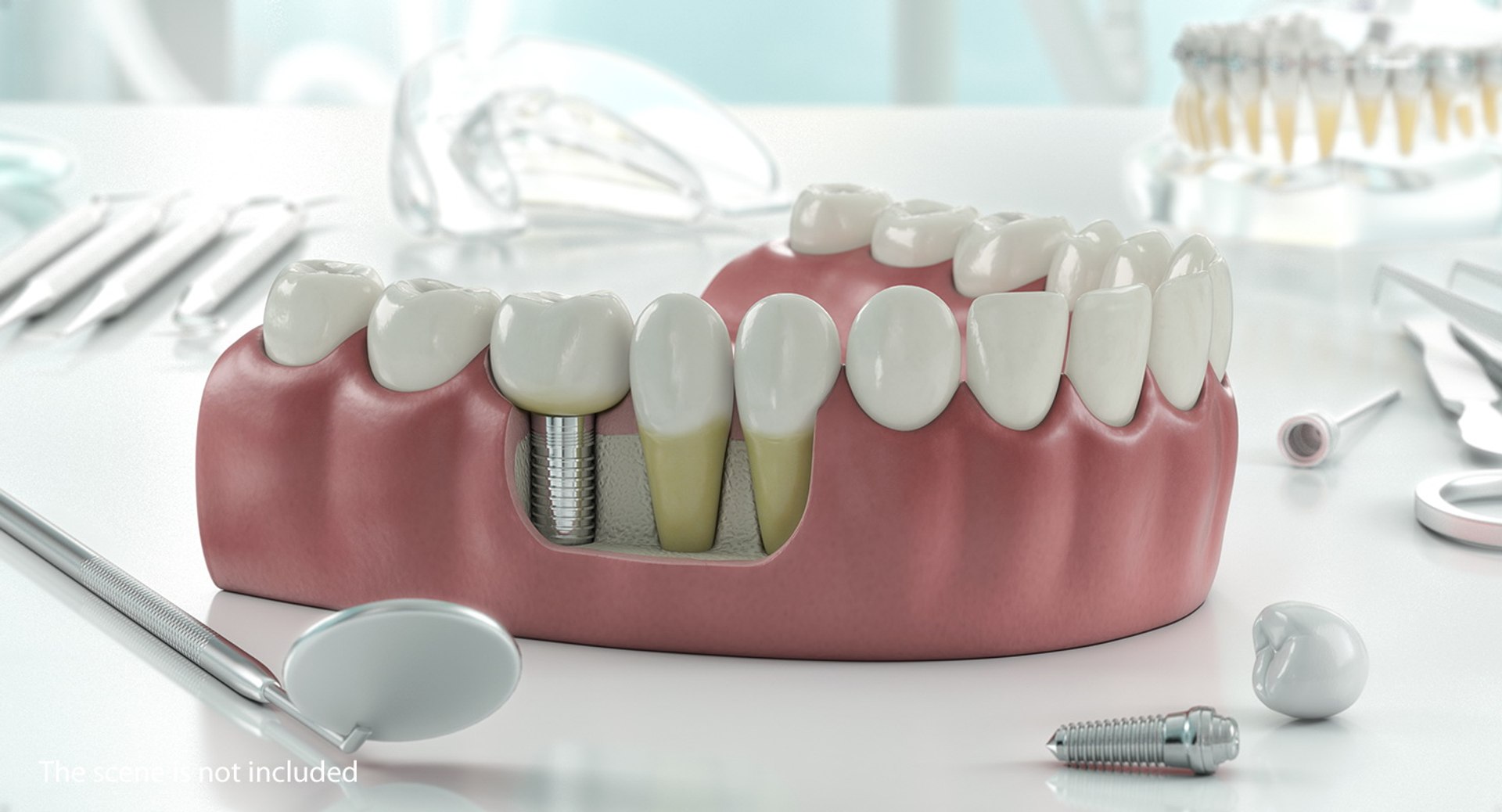 Lower teeth medical dental 3D model - TurboSquid 1428835