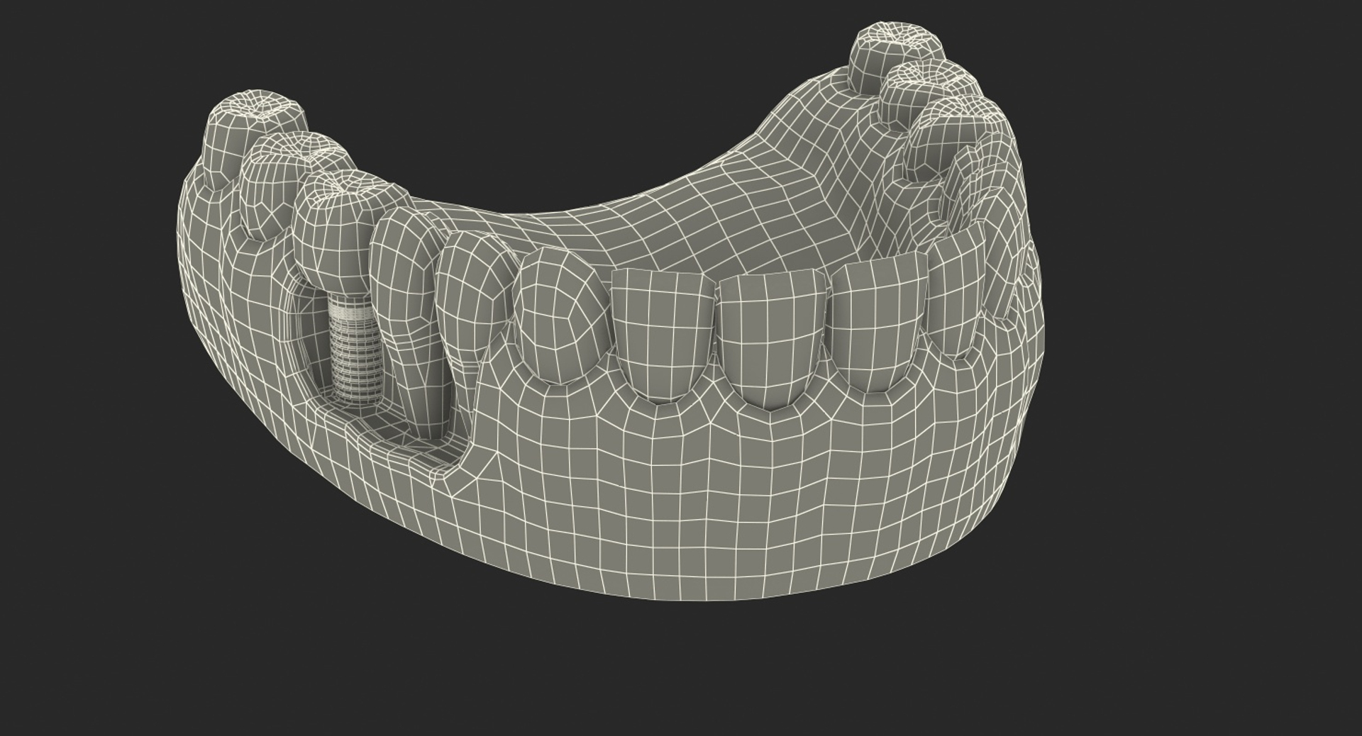 Lower Teeth Medical Dental 3D Model - TurboSquid 1428835