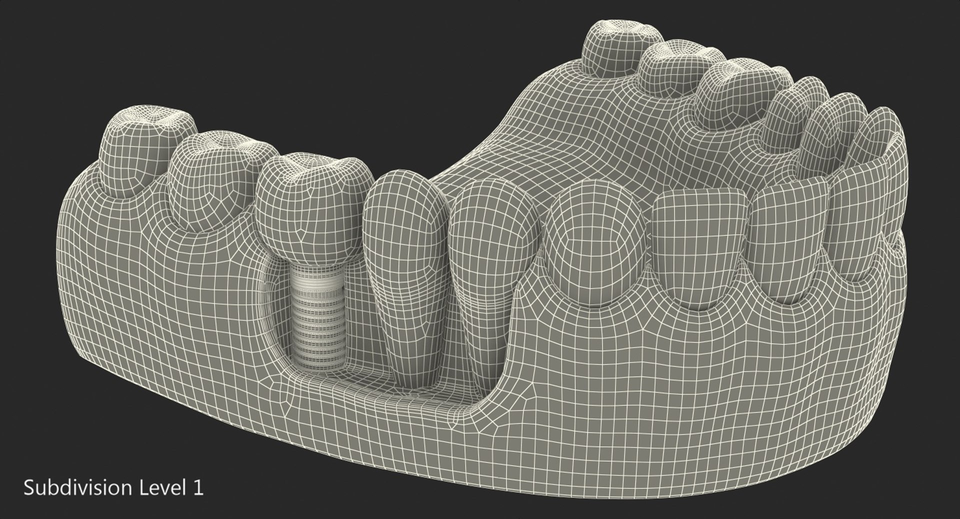 Lower teeth medical dental 3D model - TurboSquid 1428835