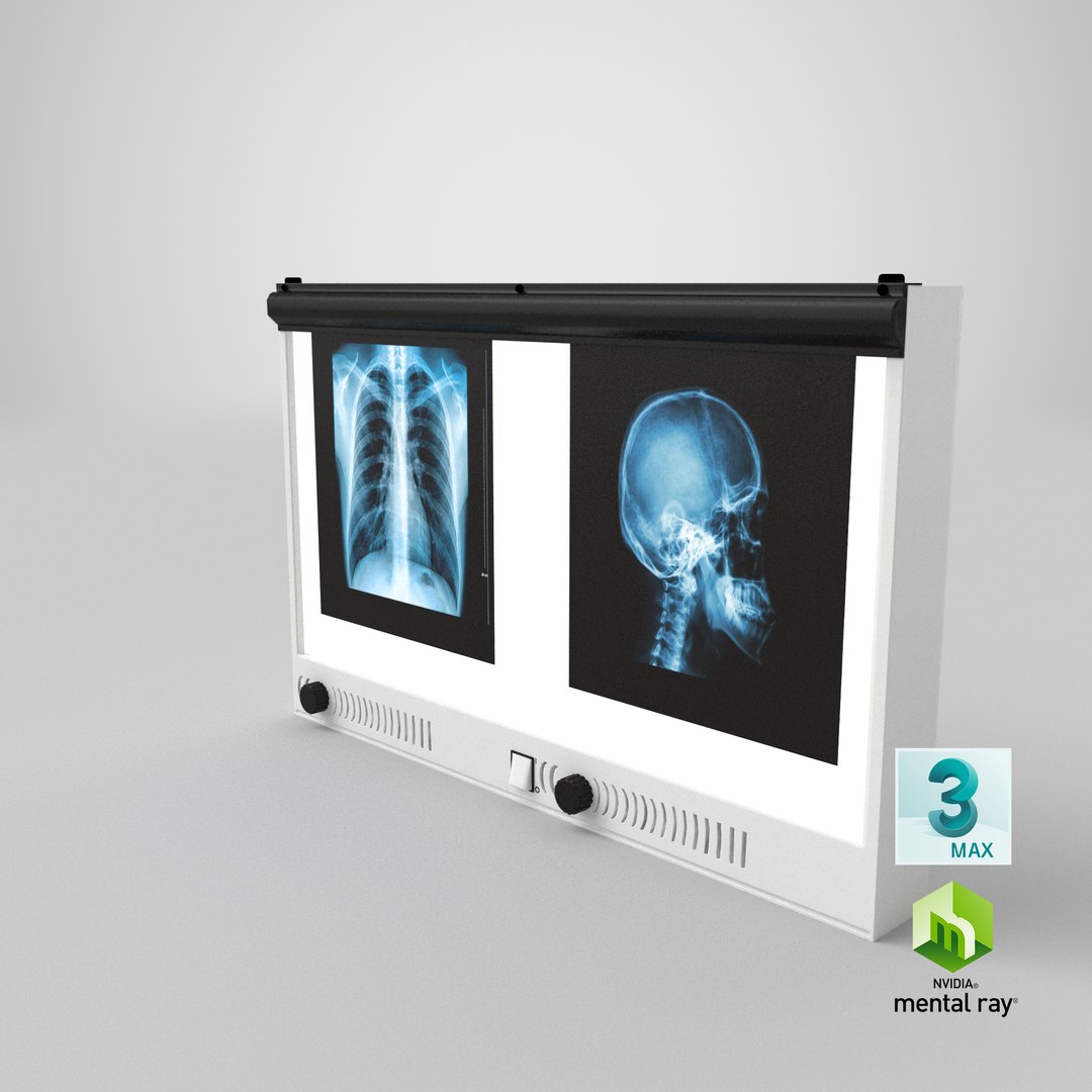 Xray Film Viewer 3D Model - TurboSquid 1885252