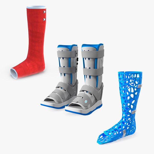 3d blue fiberglass cast arm