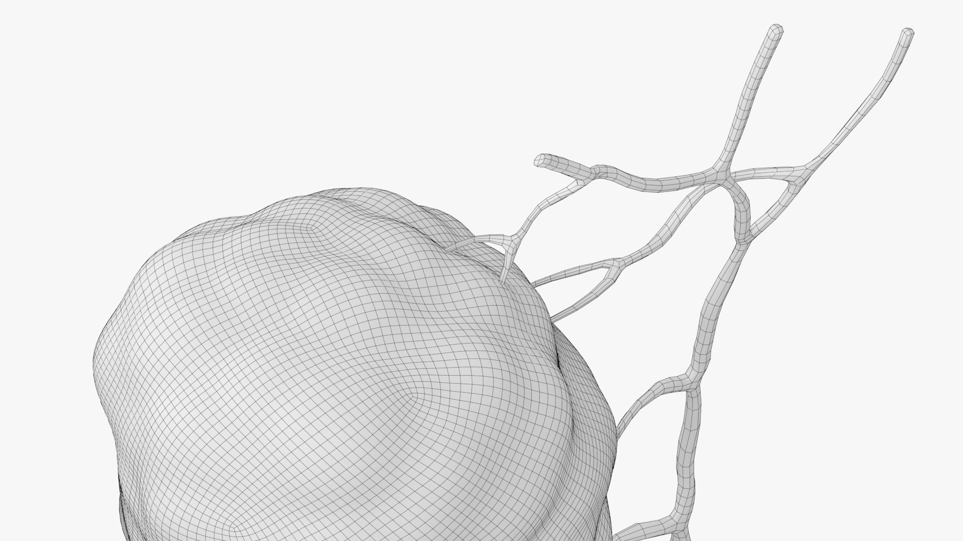 3D Palatine tonsil - TurboSquid 1933972