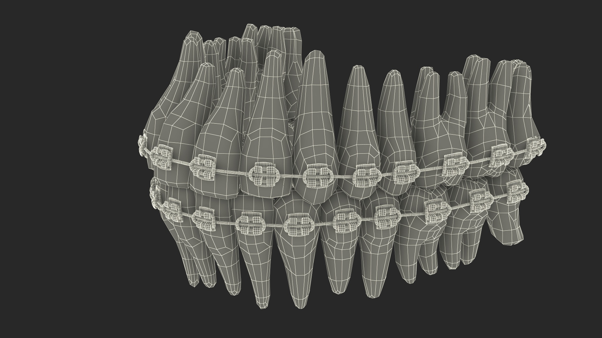 Ligature Braces On Artificial Teeth Model - TurboSquid 2335574
