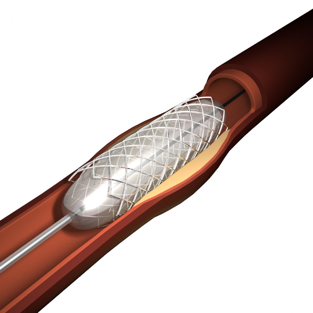 3d Obj Stent Artery