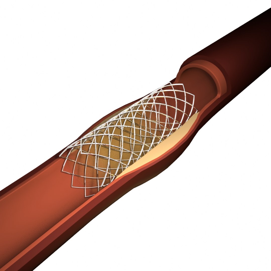 3d Obj Stent Artery