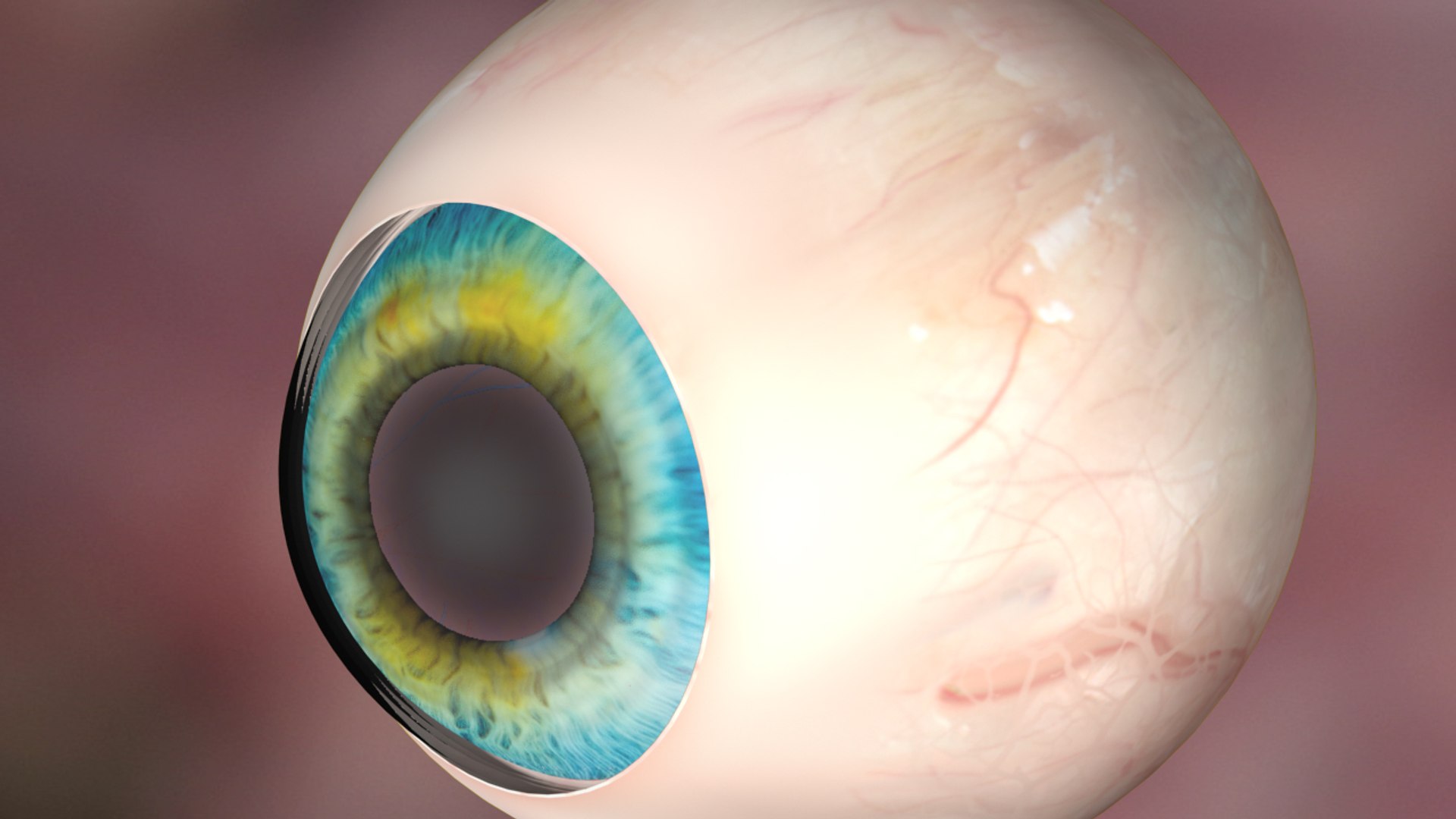 Medical Illustration Myopia 3d Max