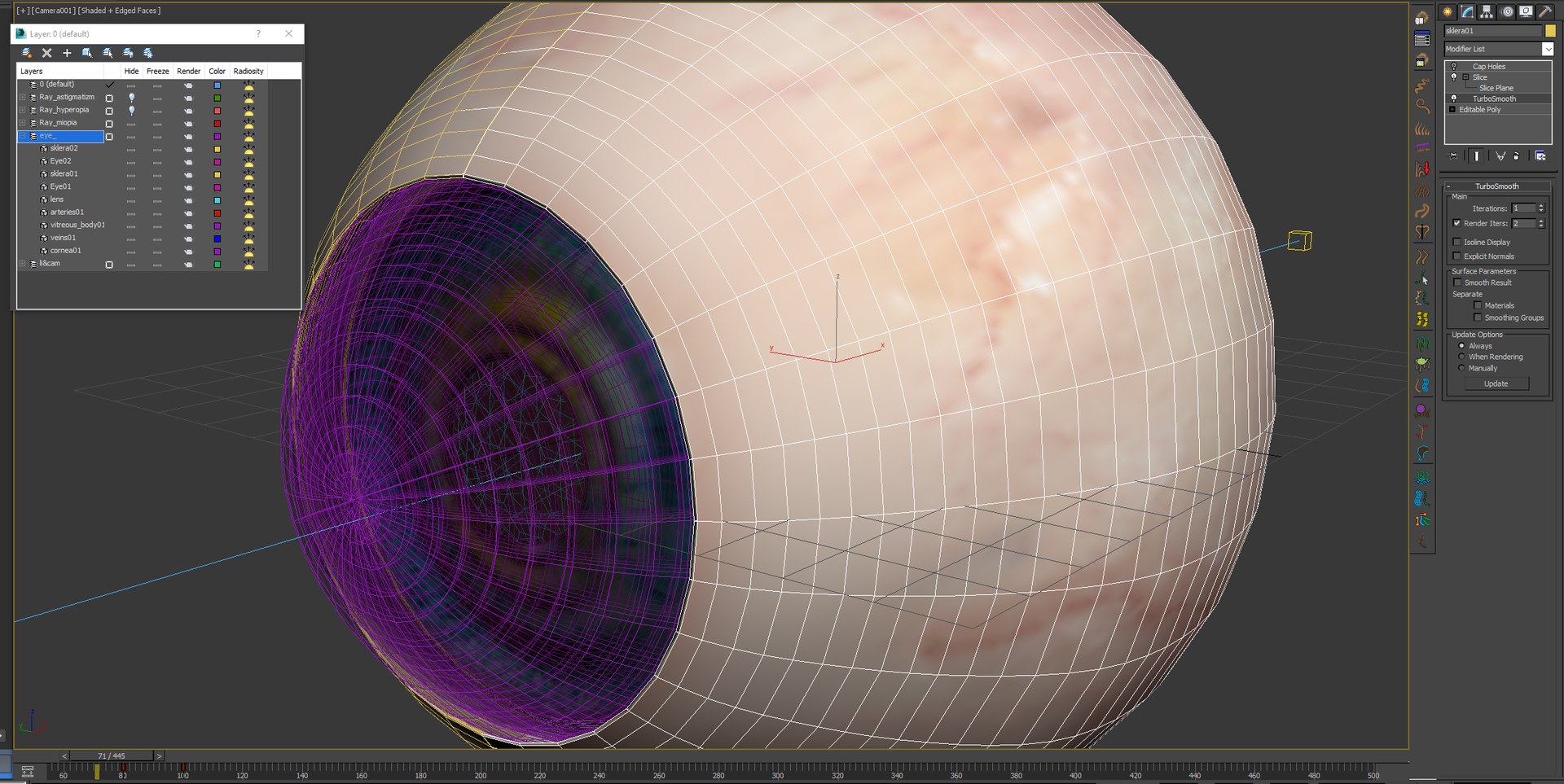 Medical Illustration Myopia 3d Max