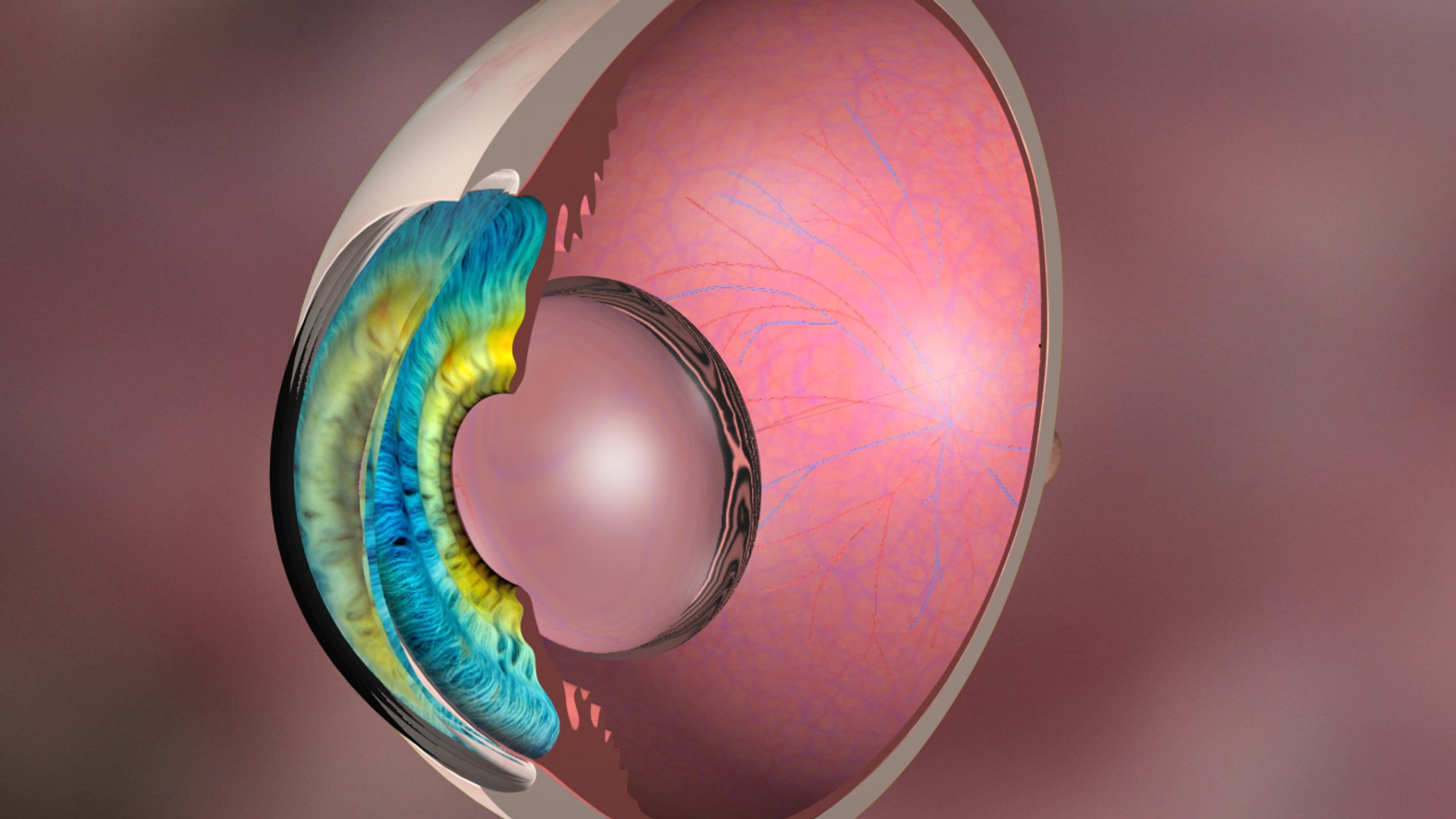 Medical Illustration Myopia 3d Max
