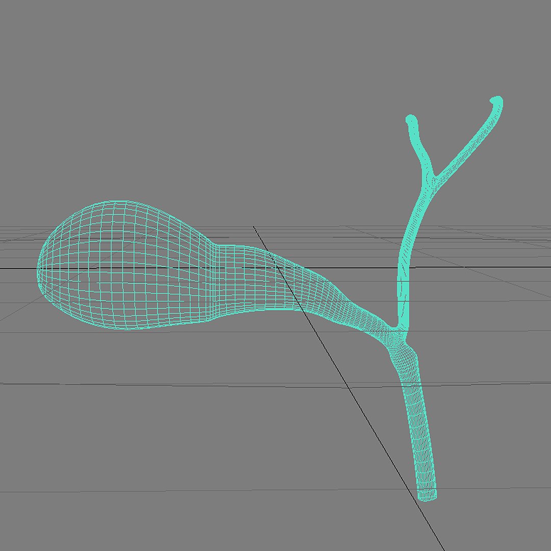 3d Model Gallbladder 2011