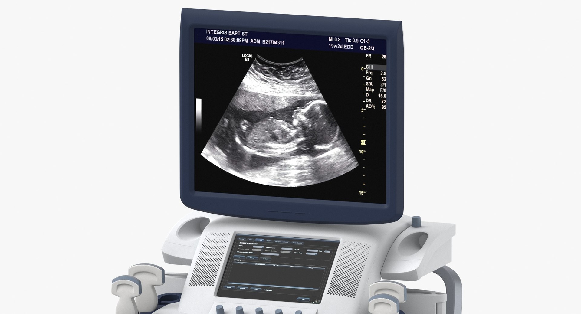 3D Ultrasound Model - TurboSquid 1924848