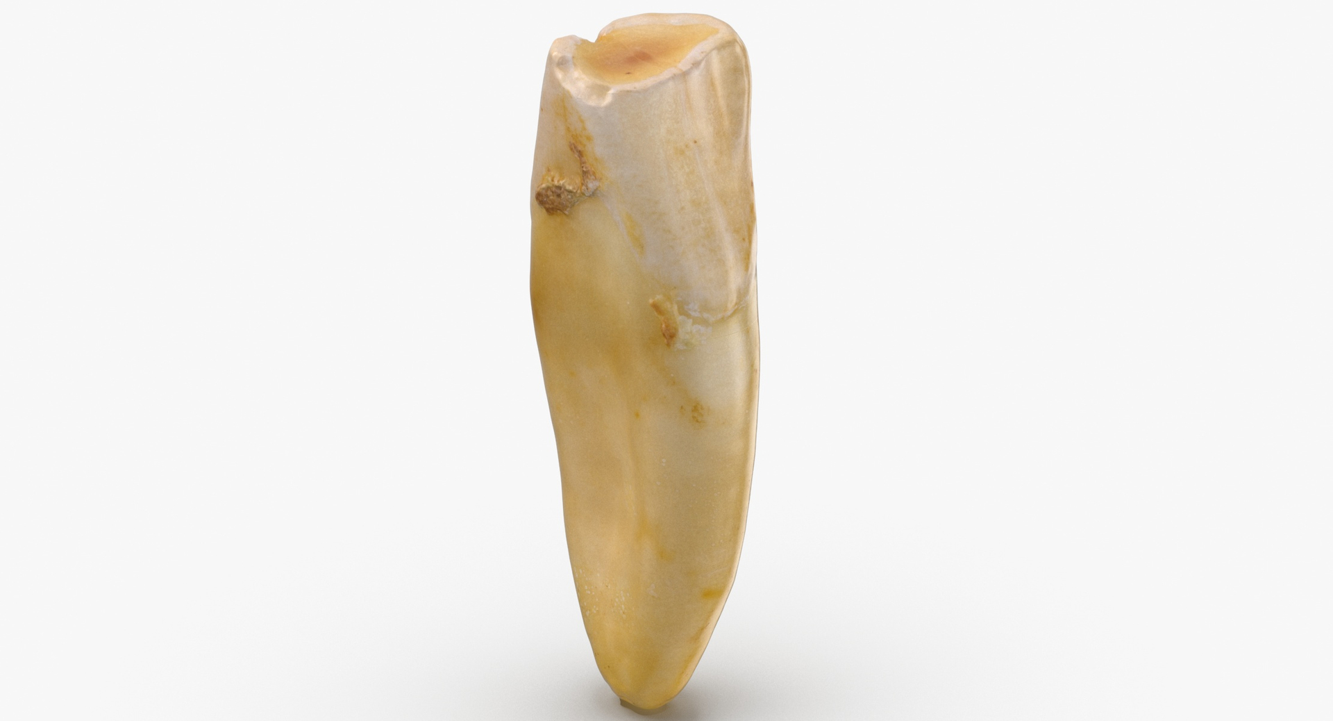 Human Teeth with Cavity and Broken Collection - 6 models 3D ...
