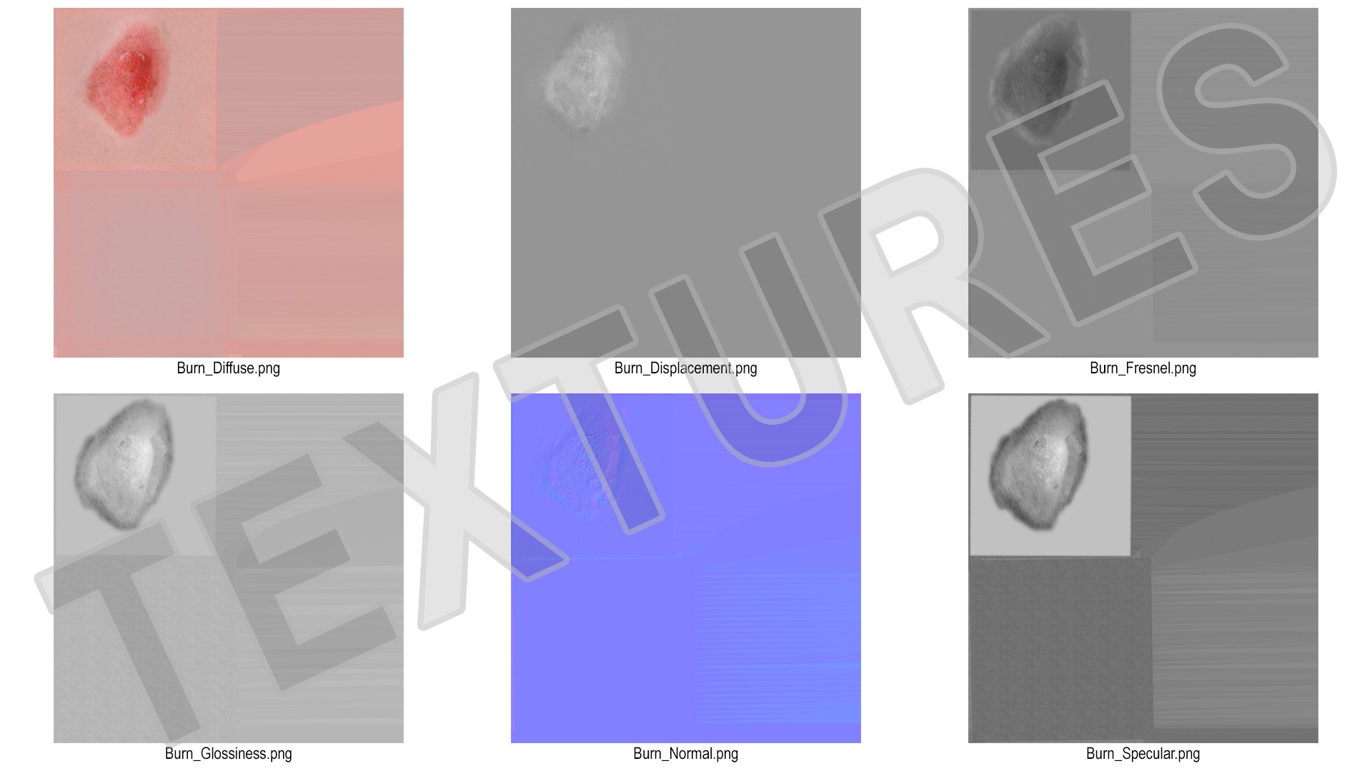 3D Burned Skin Model - TurboSquid 2159253