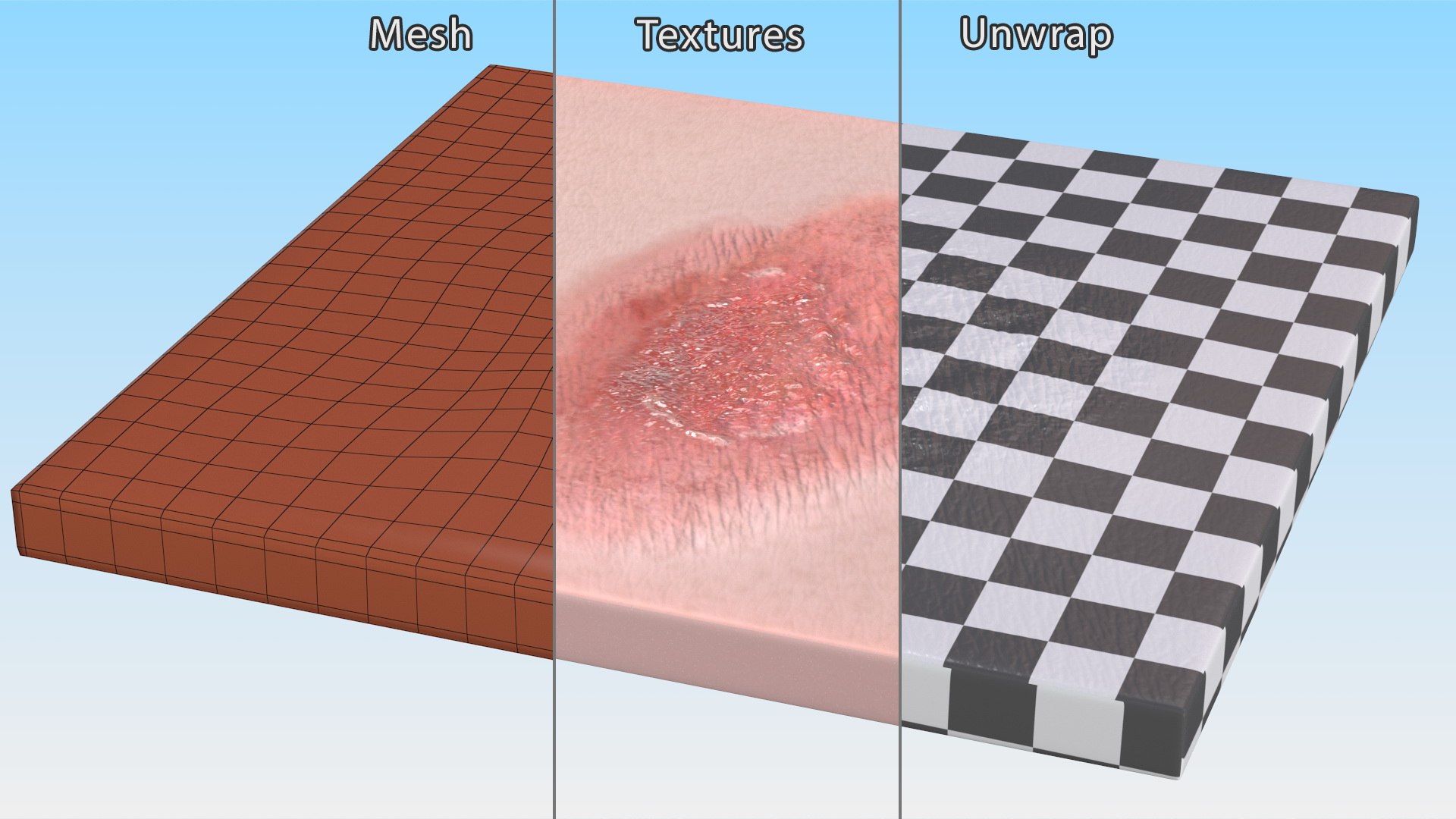 3D Burned Skin Model - TurboSquid 2159253