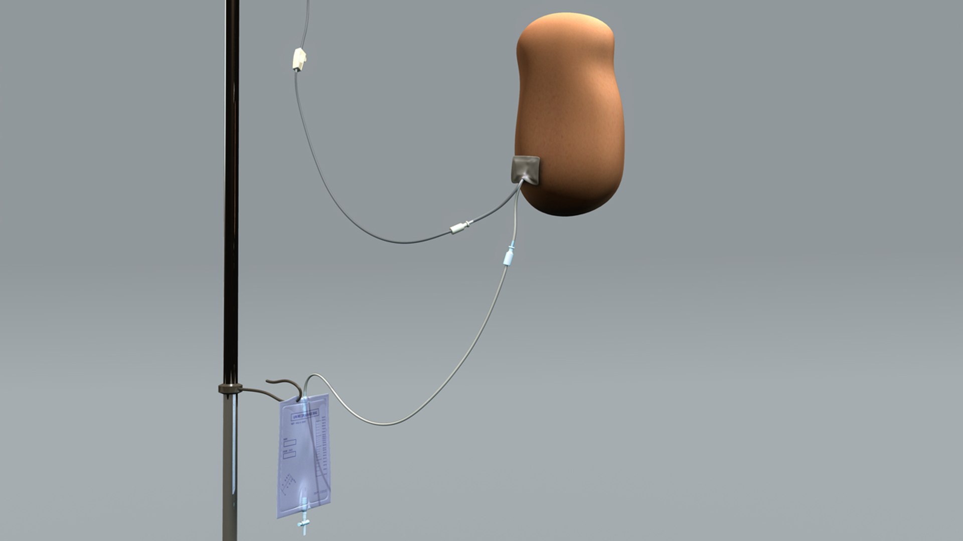 3d Model Peritonium Dialysate