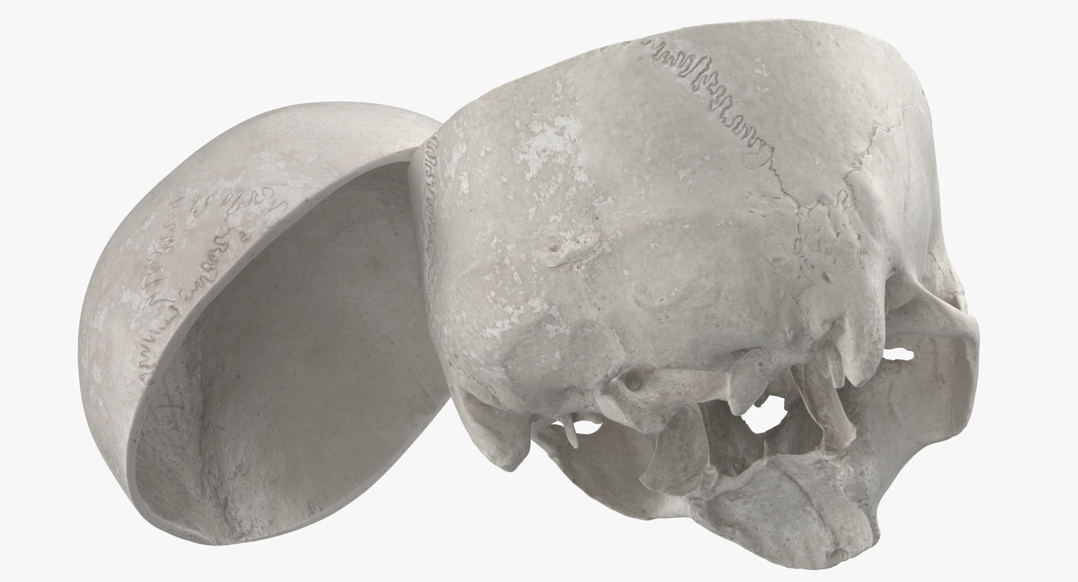 3D Human Open Skulls Collection White - 4 models model - TurboSquid 1746589