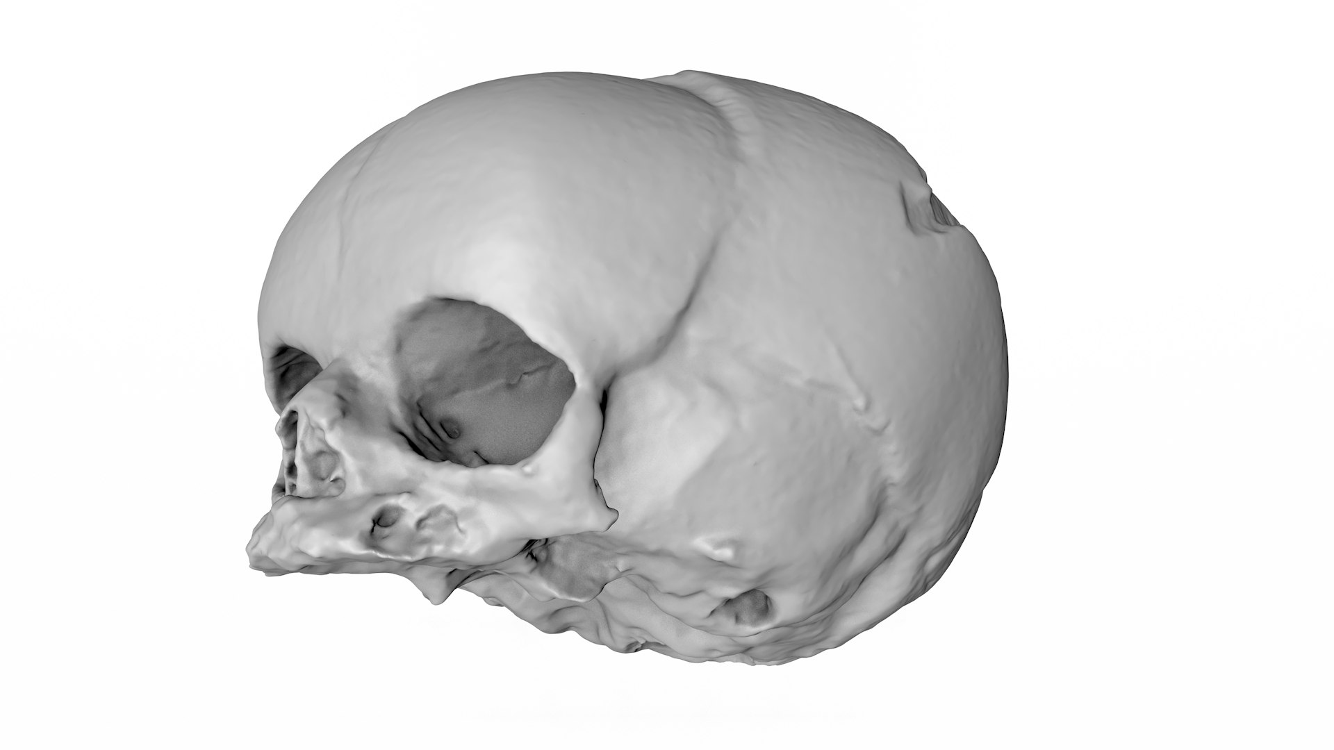 3d Skull Fetus Model