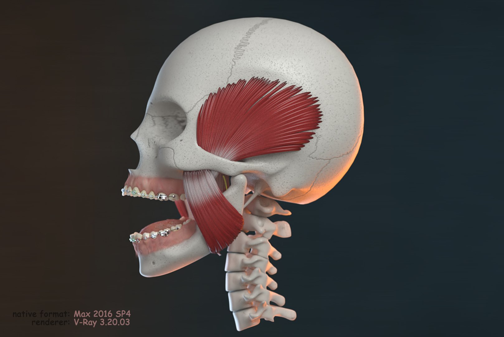 Ortho Skull V-ray Orthodontics Model - TurboSquid 1339457