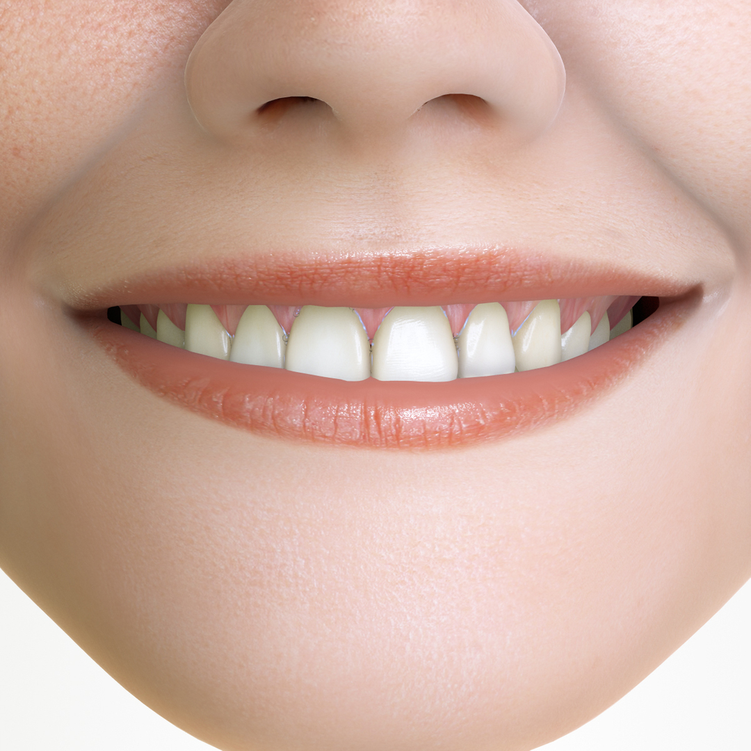 realistic orthodontic anatomy mouth max