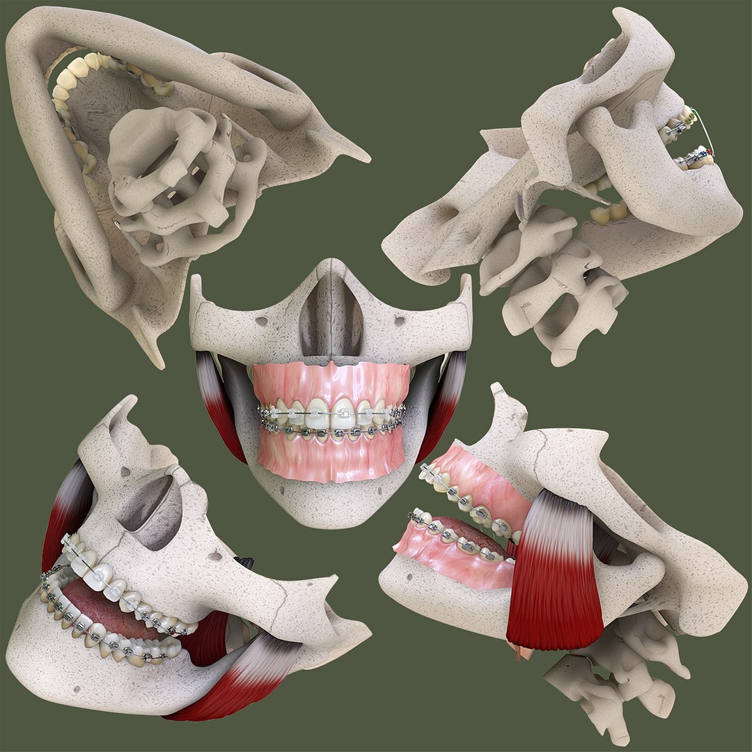 realistic orthodontic anatomy mouth max