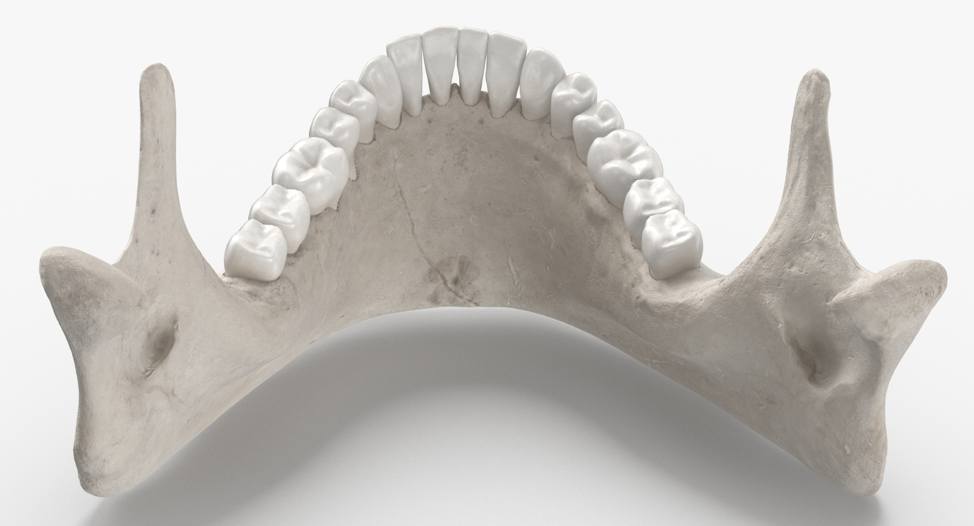 Human Male Jawbones With And Without Damages Collection White - 3 ...
