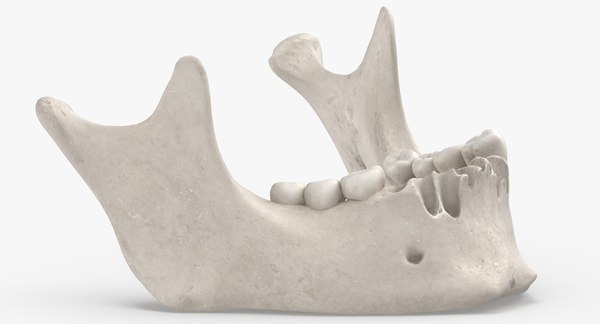 Human Male Jawbones With And Without Damages Collection White - 3 ...