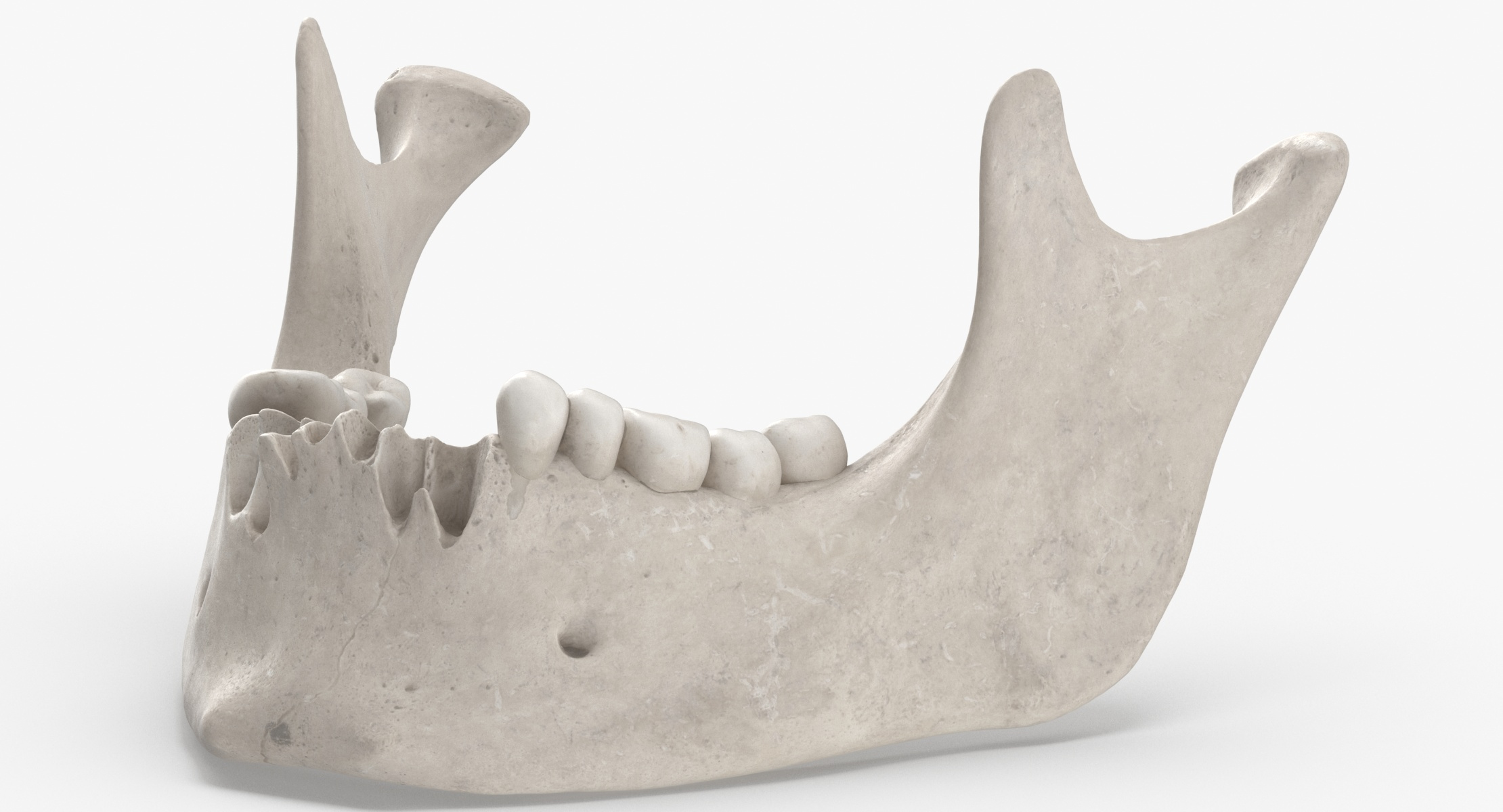 Human Male Jawbones With And Without Damages Collection White - 3 ...