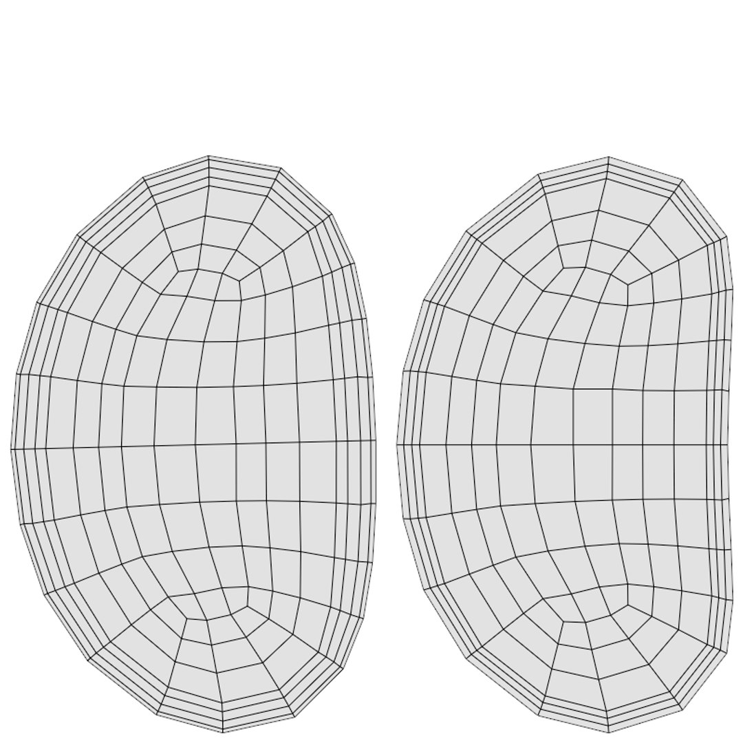 3D Surgical Kidney Tray Model - TurboSquid 2019415