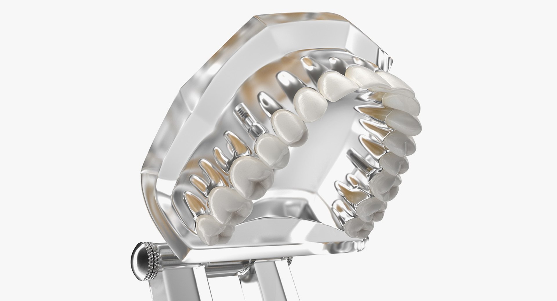 3D Transparent Dental Typodont Implants - TurboSquid 1428983