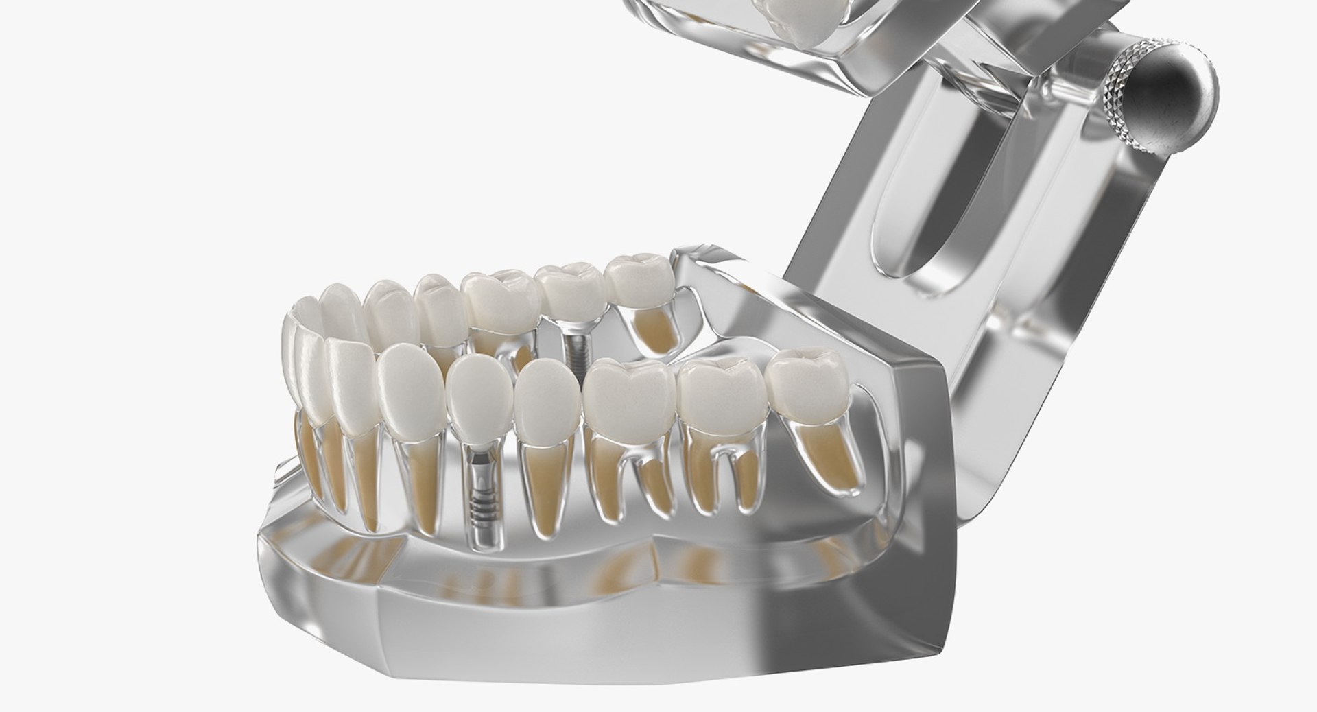 3D Transparent Dental Typodont Implants - TurboSquid 1428983