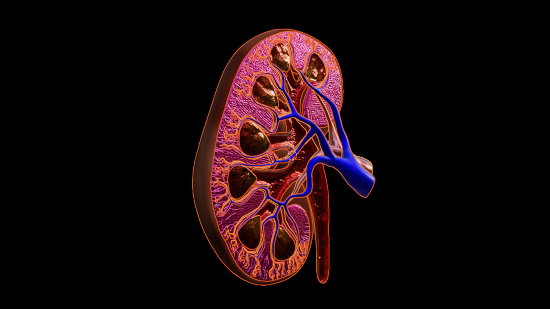 3D 3D Model of Human Kidney cross section model - TurboSquid 2077213
