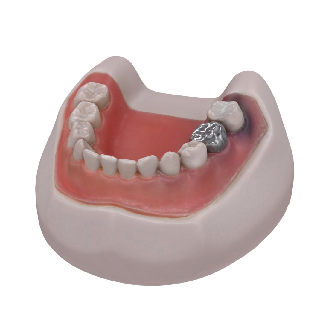 3d Model Of Typodont Scanned Harvard