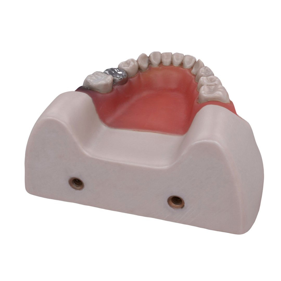 3d model of typodont scanned harvard