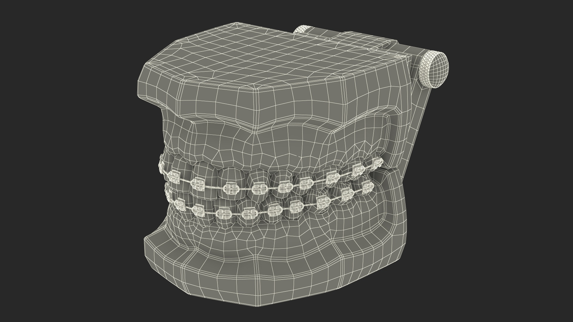 3D Model Ligature Braces On Teeth Model - TurboSquid 2335696