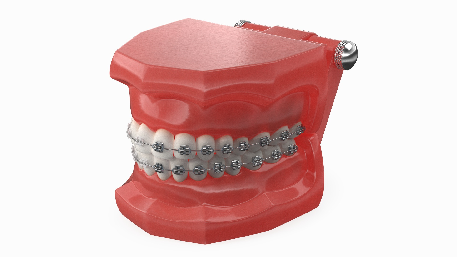 3D Model Ligature Braces On Teeth Model - TurboSquid 2335696
