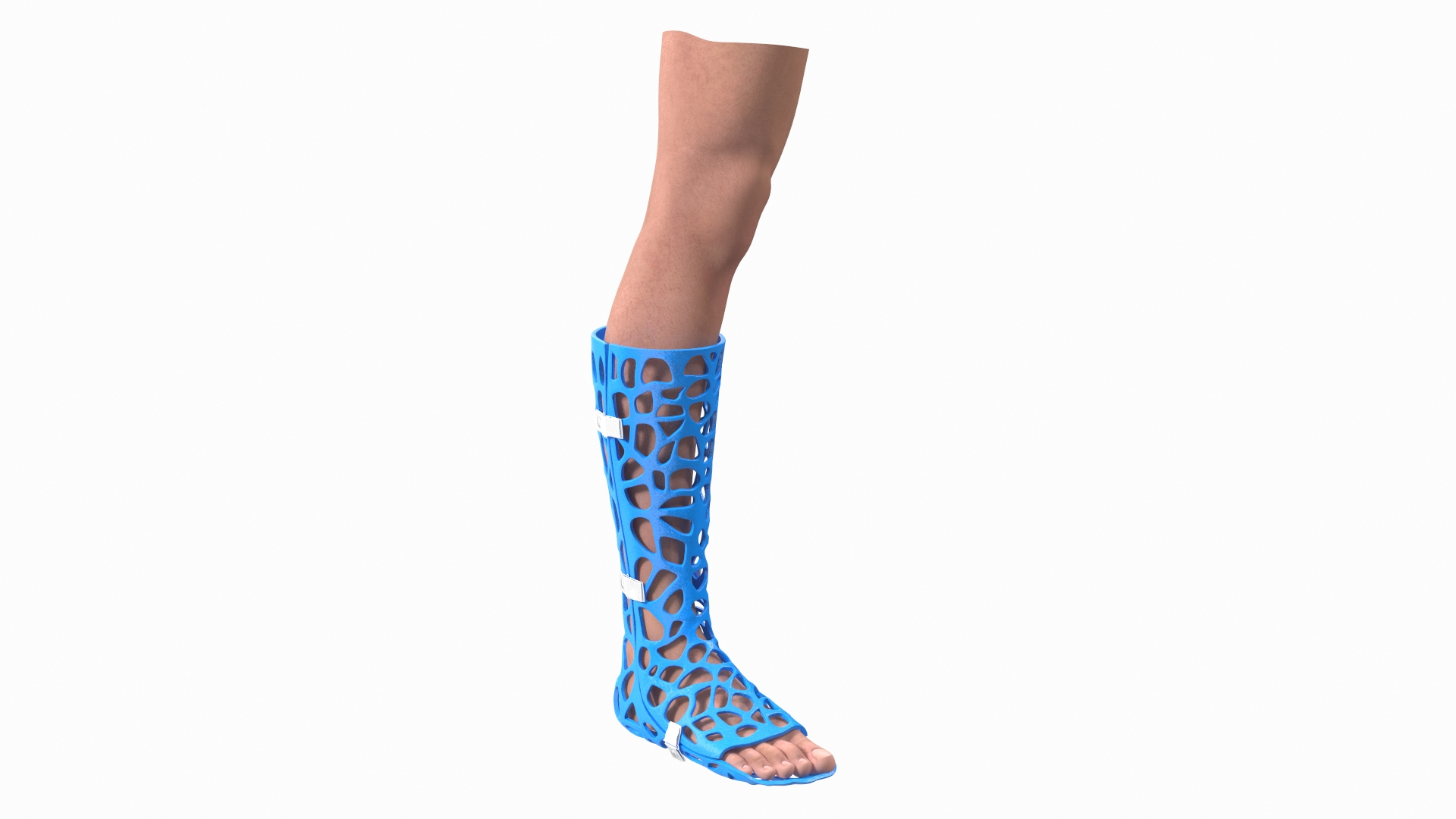3D-Printed Orthopedic Cast On Leg Model - TurboSquid 1900350