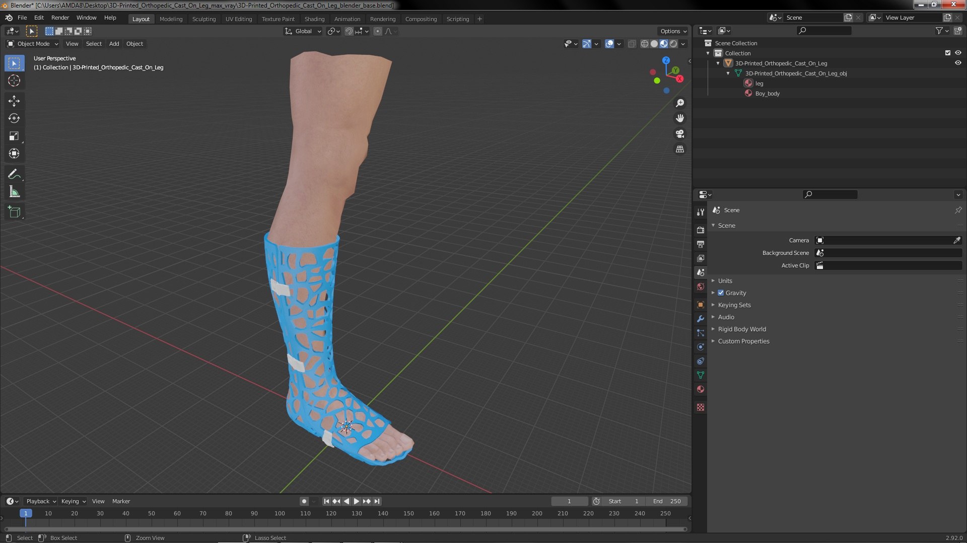 3D-Printed Orthopedic Cast On Leg Model - TurboSquid 1900350