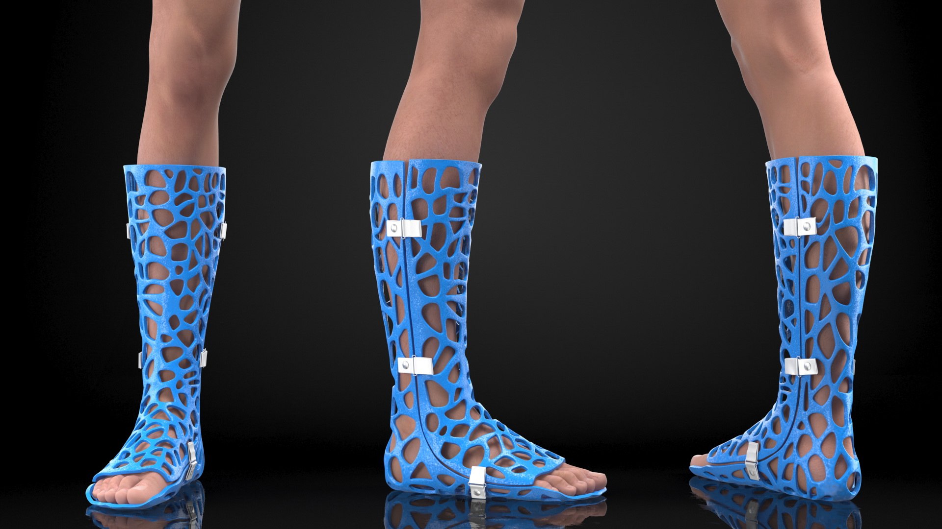 3D-Printed Orthopedic Cast On Leg Model - TurboSquid 1900350
