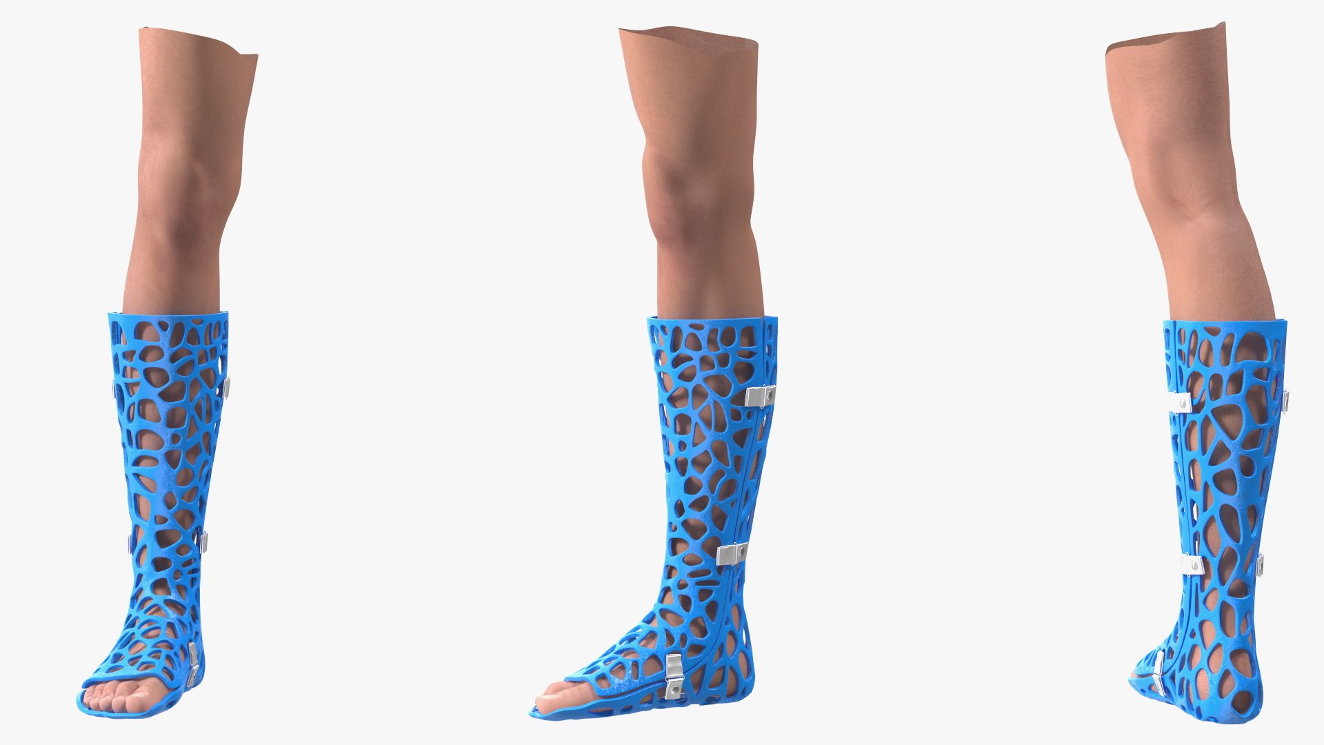 3D-Printed Orthopedic Cast On Leg Model - TurboSquid 1900350