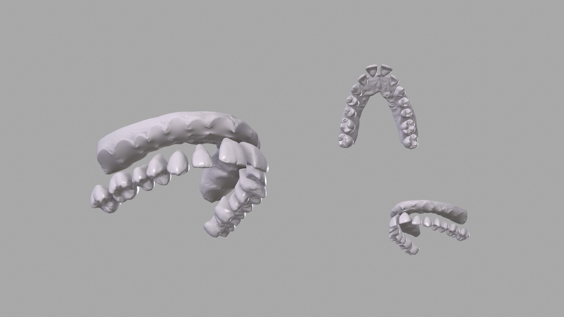 3D Dental Upper Jaw 3D Scanned Mouth With Separated Teeth 3D Print ...