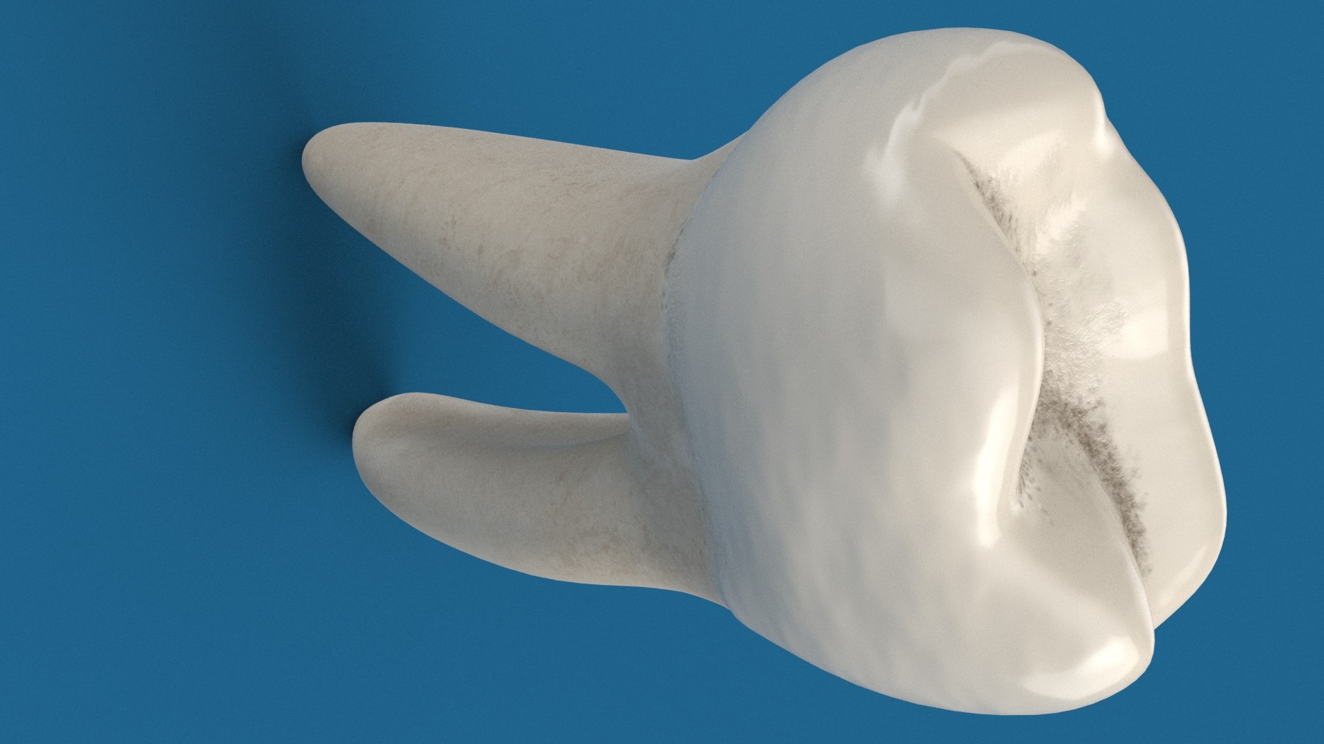 Molar Tooth 3D Model - TurboSquid 1489906